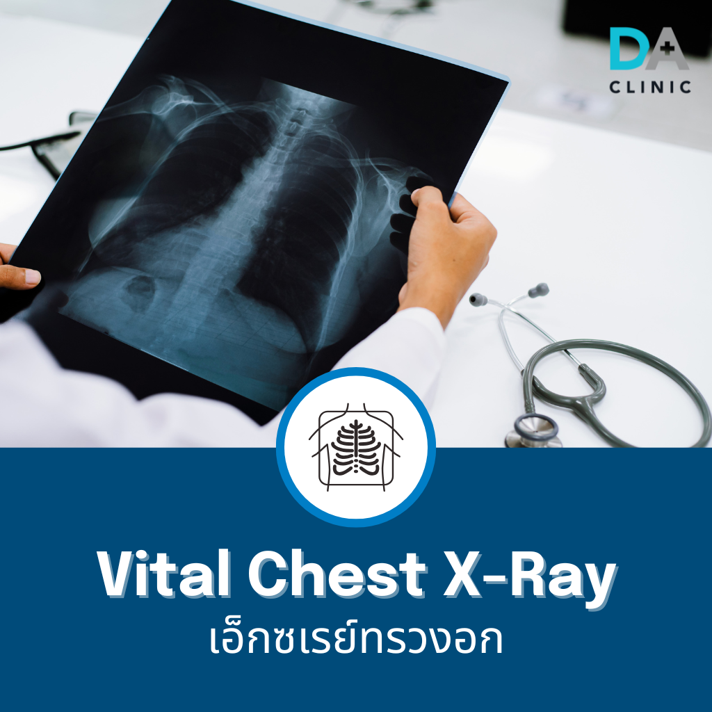 Vital Chest X-Ray | Doctor Anywhere Marketplace