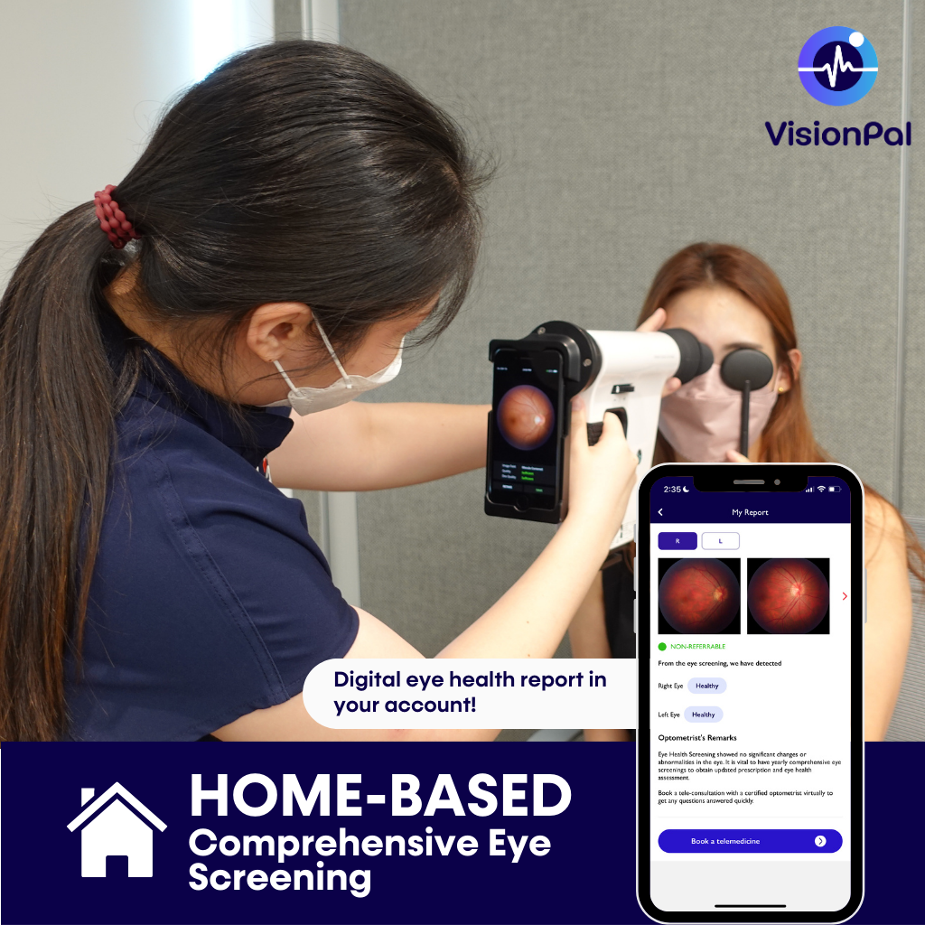 VisionPal - Eye Screening - 4 Pax (Home-Based) | Doctor Anywhere ...